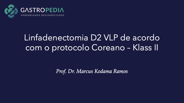 Linfadenectomia D2 VLP de acordo com o protocolo Coreano – Klass II - Gastropedia