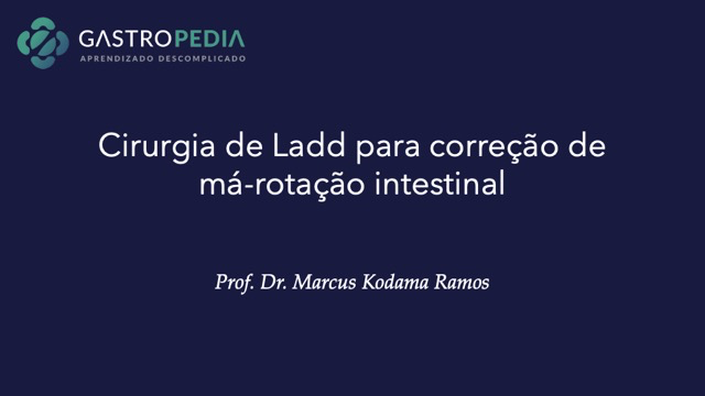 Cirurgia de Ladd para correção de má-rotação intestinal - Gastropedia