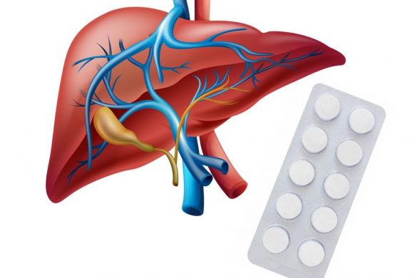 Hepatic nodule detected by ultrasonography: step by step of when and ...