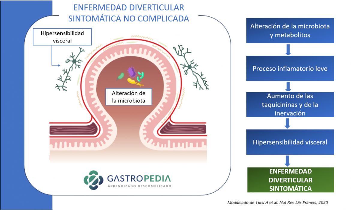 Enfermedad diverticular del colon: epidemiología y fisiopatología ...