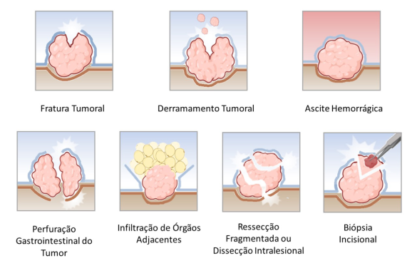 Procinéticos: Mecanismo de Ação, Indicações e Segurança - Gastropedia